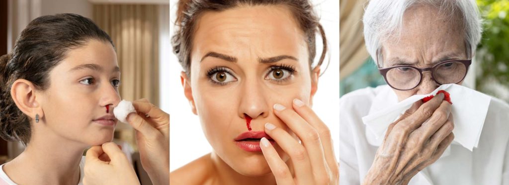 Saignement de nez : le comprendre et comment l'arrêter | Coalgan Gamme